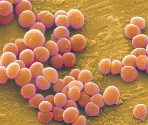 Staph Infection Mahaba Herbal Limited
