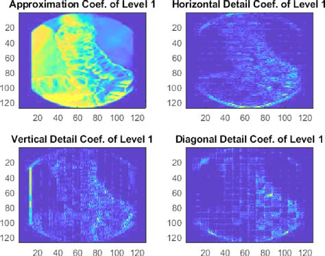 Figure 2 From Stationary Wavelet Transform Based Semi Blind Medical