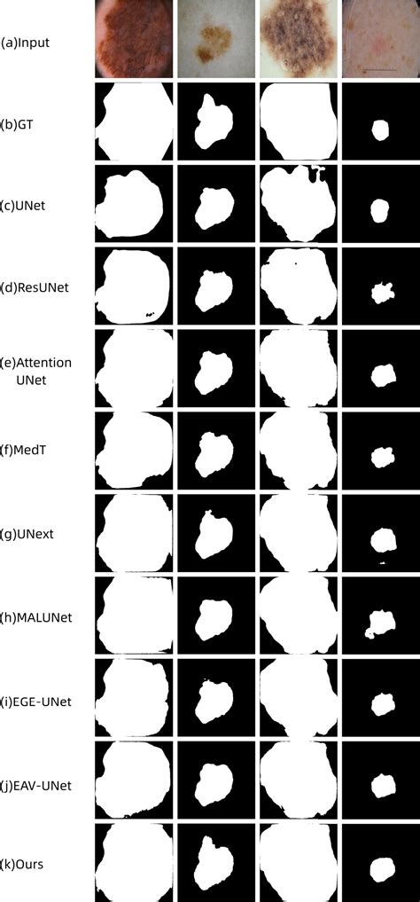 attention based multi scale nested network for biomedical image