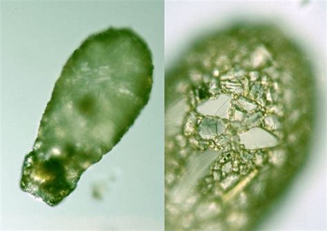 Protist Images Difflugia Oblonga