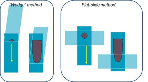 Cytology Sampling Techniques Flashcards Quizlet