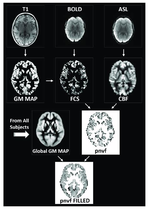 Flowchart Of The Data Processing Routines For The Estimation Of The