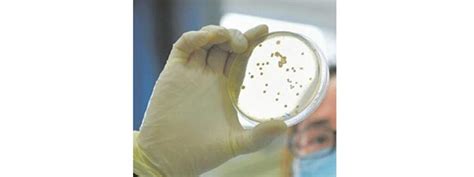 Bioburden And Sterility Testing For Medical Devices Labinsights