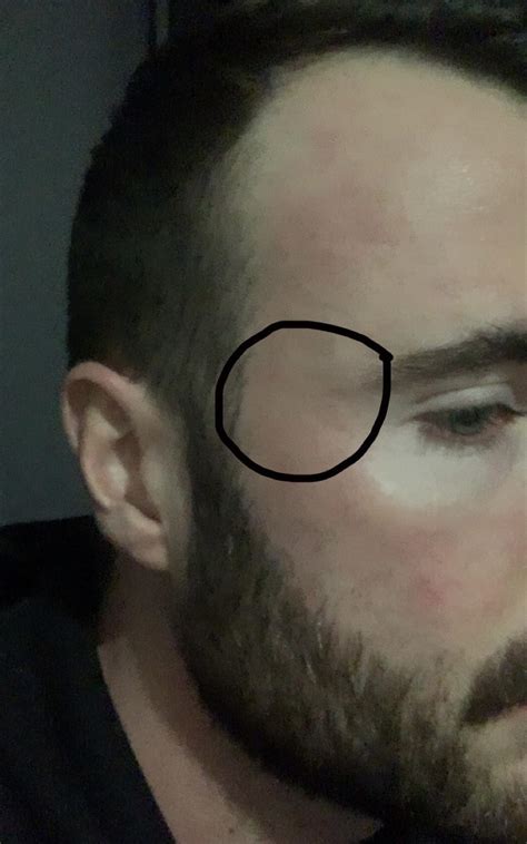 249 Best R Tmj Images On Pholder So True Lol