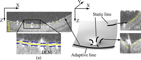 User Guided Segmentation For Volumetric Retinal Optical Coherence Tomography Images