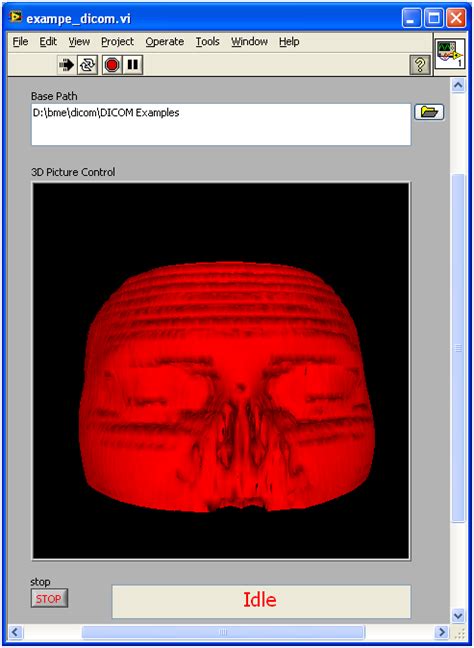 How To Use NI Biomedical Startup Kit Source Code Load And Visualize DICOM Images In