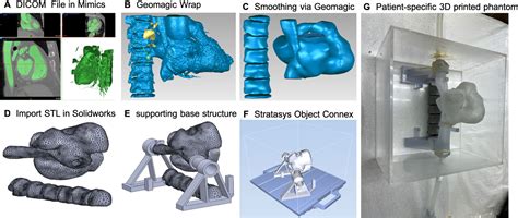 Deep Learning Driven Catheter Tracking From Bi Plane X Ray Fluoroscopy Of 3d Printed Heart Phantoms