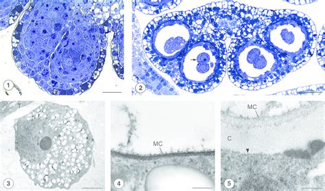 Microspores In An Angiosperm