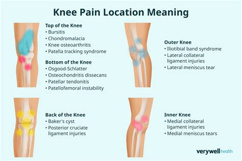 Sports Medicine Shoulder Anatomy Athletic Injuries Of The Knee