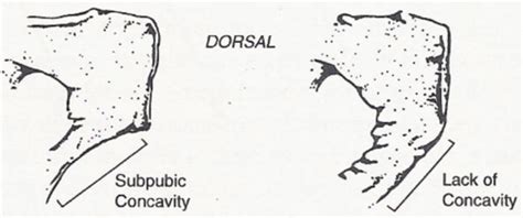 Subpubic Concavity
