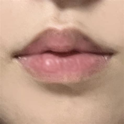 시술수술 질문 입술필러 입꼬리 강남언니 1등 성형수술and피부시술 정보앱