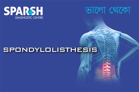 Spondylolisthesis Sparsh Diagnostic Center