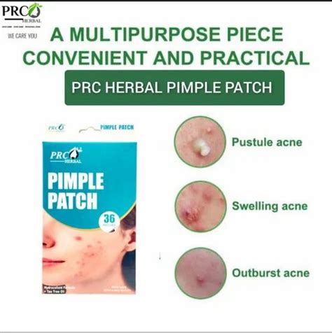 Acne Pimple Patch At ₹ 58 Piece In Hyderabad Id 2853618725233