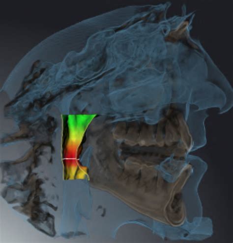 DENTAL AIR – Dental Diagnostic RX