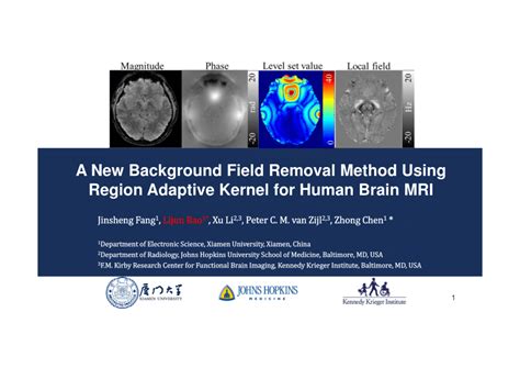 Pdf A New Background Field Removal Method Using Region Adaptive Kernel For Human Brain Mri