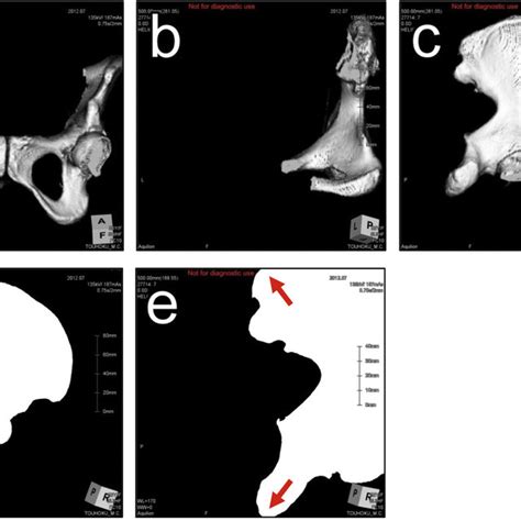 Classification Of Judet And Letournel Download Scientific Diagram