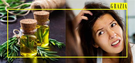 Say Goodbye To Your Itchy Scalp Grazia India