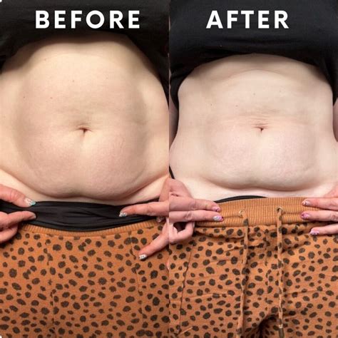 C Section Overhang Total Rehab Hannah Johnson Therapies