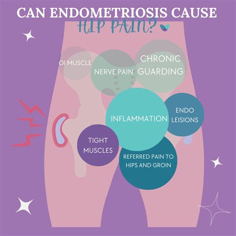 How Endometriosis Affects Your Hip And Groin Pelvic Rehabilitation