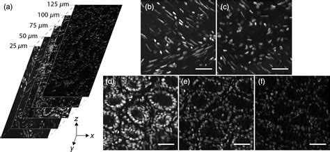 Tunable Structured Illumination Light Sheet Microscopy For Background Rejection And Imaging