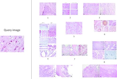 Sample Image Query And Results Provided With Content Based Retrieval Download Scientific Diagram
