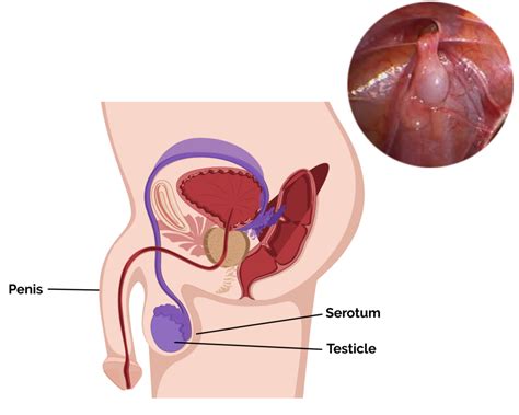 Advanced Nephrectomy Solutions Open And Laparoscopic