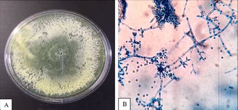 A Trichoderma Grown On Pda At 25 ± 2°c After 7 Days Of Incubation