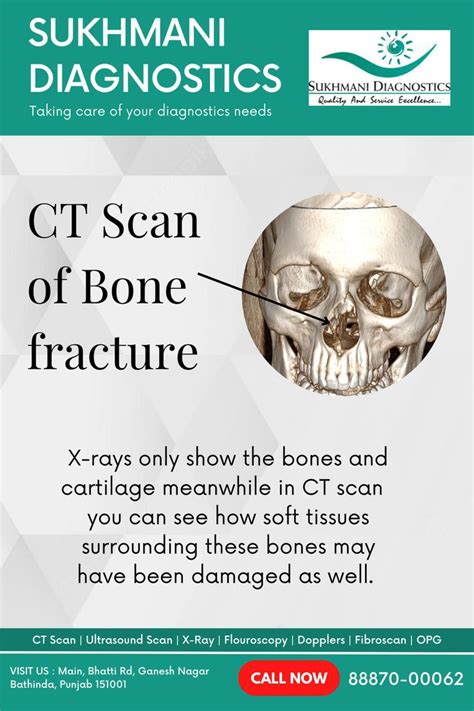 Ct Scan Of Bone Fracture 🩻 Sukhmani Diagnostics Ct Scan Bone