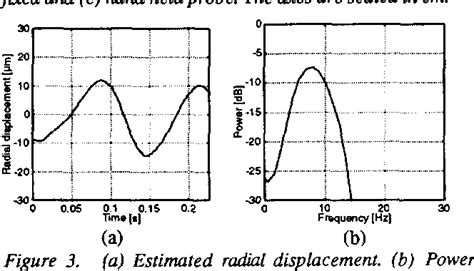 Figure 3 From Ultrasound Clutter Signal From Vibrating Muscles Limits