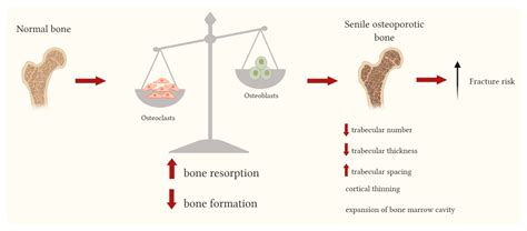 Bone Remodeling Diagram