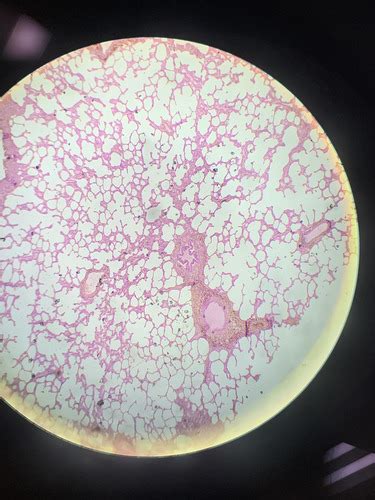 Lab 2 Microscope Pics Flashcards Quizlet