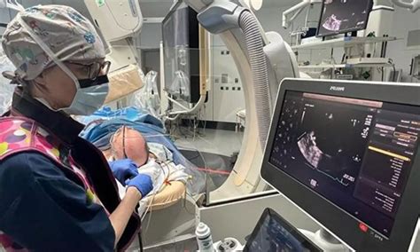 What Are Predictive Factors For Difficult Tee Probe Insertion In Adult Cardiac Surgery Patients