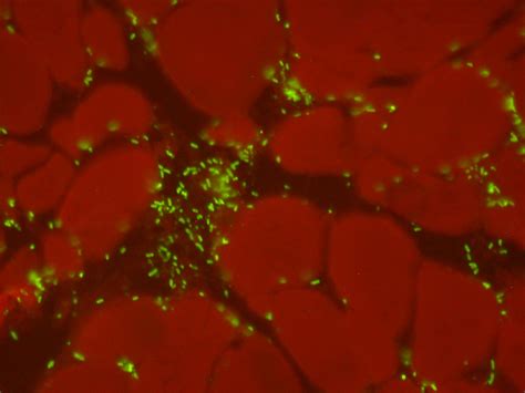 Cattle Deaths Due To Clostridium