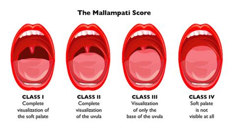 Anesthesia Lecturio Quizlet Anesthesia Lecturio Quizlet