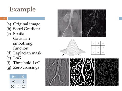 Ppt Edge Detection Powerpoint Presentation Free Download Id 1320540