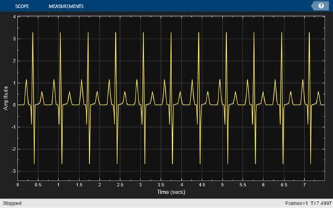 Timescope Display Time Domain Signals Matlab