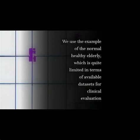 Multivariate Multi Scale Permutation Entropy For Complexity Analysis Of Alzheimers D Rtcl