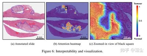 transmil transformer based correlated mil for wsi classification