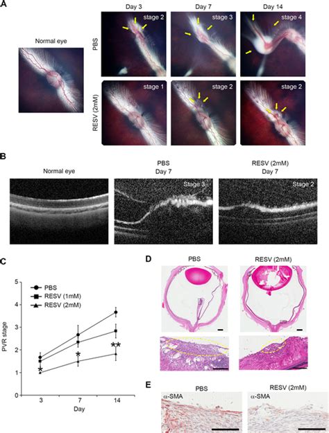 Resv Inhibits Progression Of Experimental Pvr In Rabbits A Ocular Download Scientific
