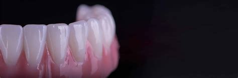 Implants With Integrity Integrity Dental Services
