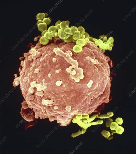 Chlamydia Infection Sem Stock Image C048 9386 Science Photo Library