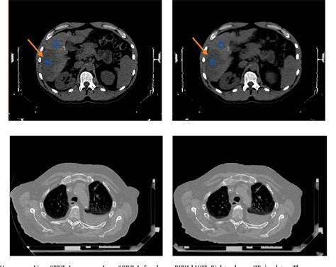 Figure 4 From Evaluation Of Fan Beam Kilovoltage Computed Tomography Image Quality On A Novel