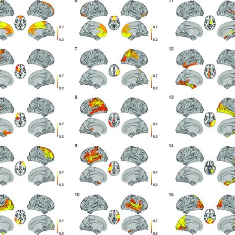 Schematic Illustration Of Wilson Cowan Units A The Model Of A Download Scientific Diagram