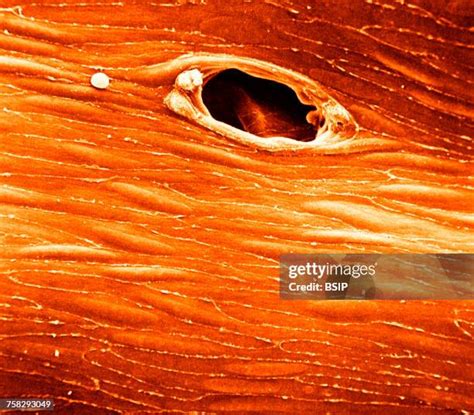 Sem Epithelial Cell Photos And Premium High Res Pictures Getty Images