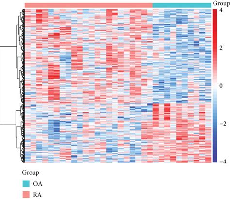 Identification Of Differentially Expressed Genes Between Ra And Oa In