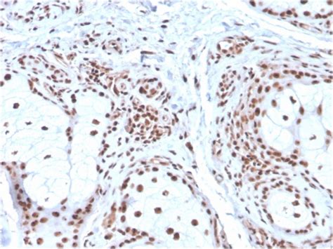 Nucleophosmin Monoclonal Antibody Npm1 3286 4869 Msm6 P1