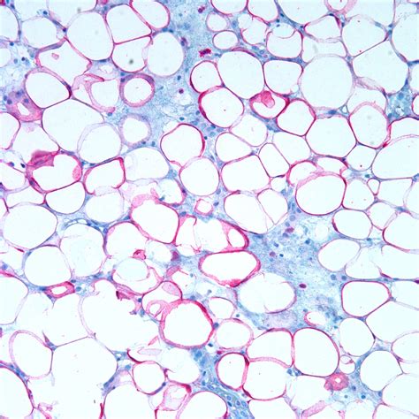 Adipose Tissue Diagram Connective Tissue Types And Examples Govyr