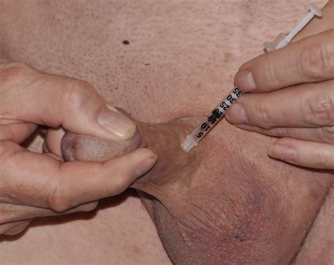 Im Injection 59 Photos Porn