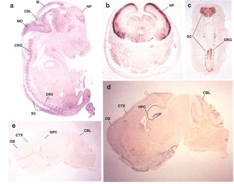 Expression Analysis Of Iqsec2 Mrna During Embryonic And Postnatal Download Scientific Diagram