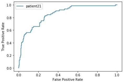 Roc Curve Of Cnn Svm Right And Cnn Left Classifiers For Patient 21
